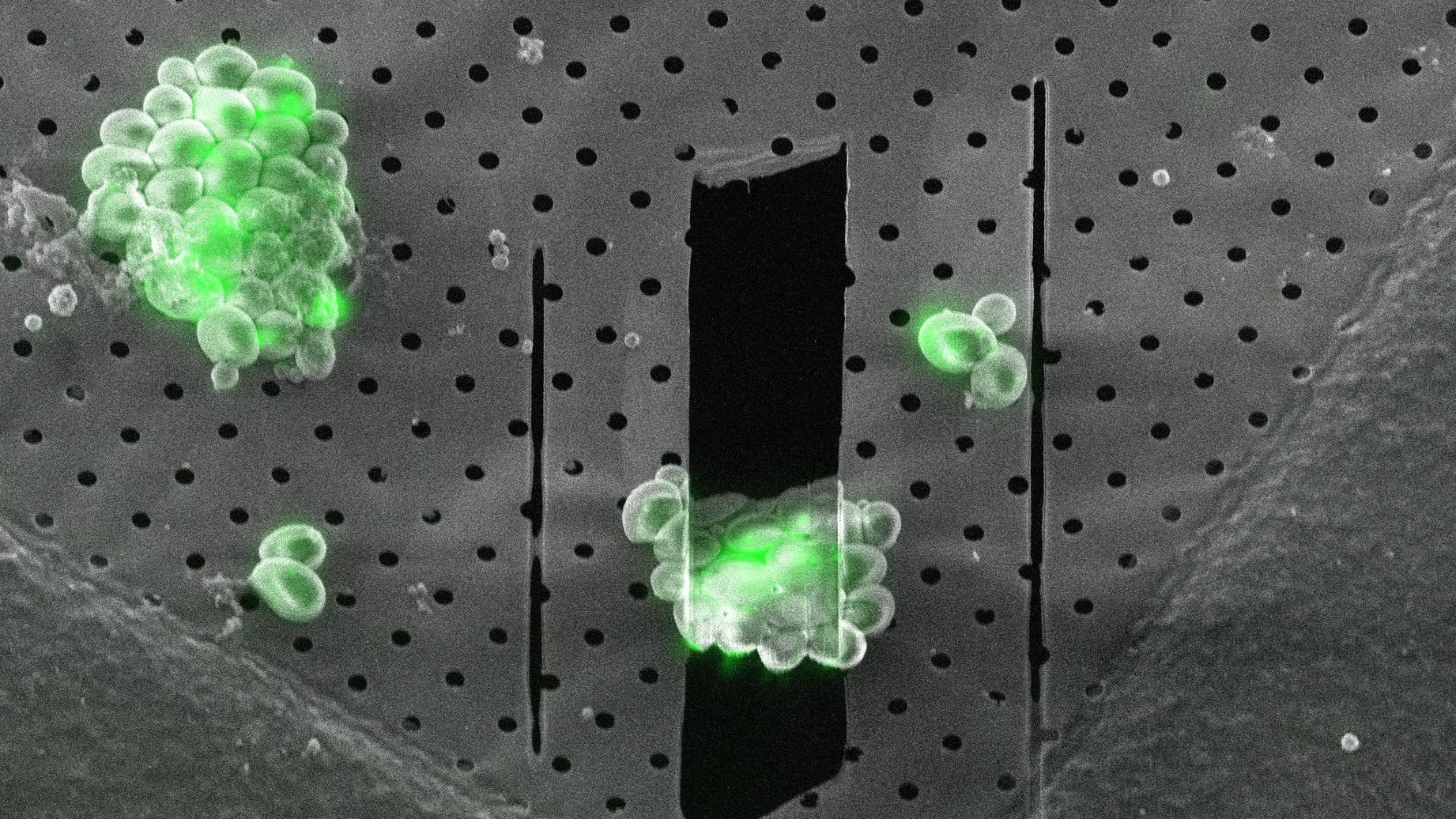 METEOR | Reduce transfer steps and improve sample yield with integrated cryo-CLEM
